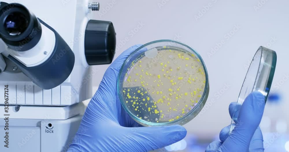 Bacteria analysis on a Petri dish, the scientist opens a Petri dish ...
