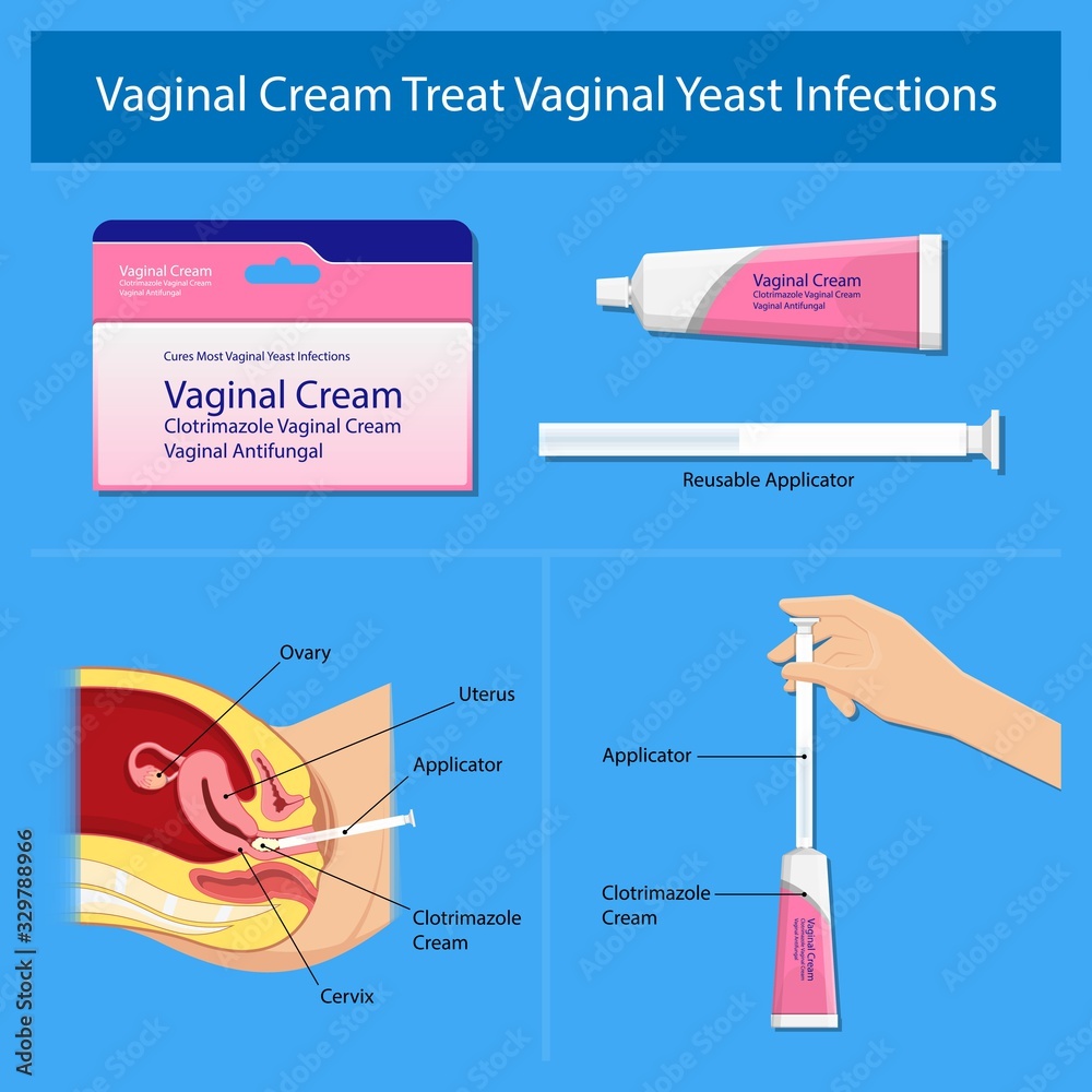 Vaginal Yeast Infections Treatment Applicator Symptoms Natural Remedies