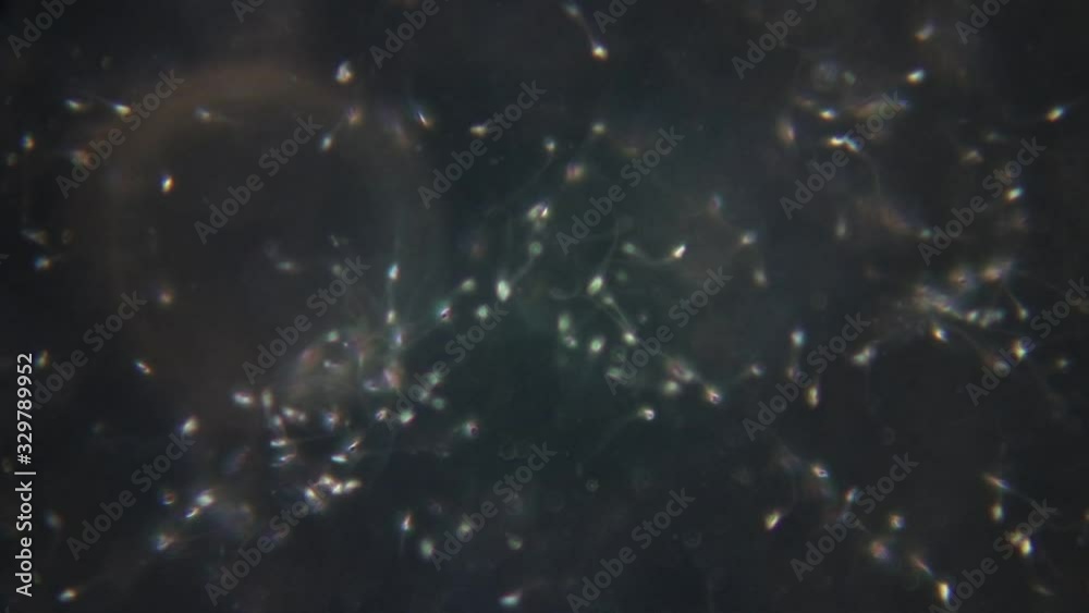 Semen, seminal fluid of Human under the microscope. Stock ビデオ | Adobe Stock