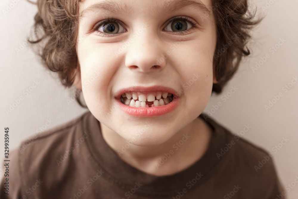 Charming curly boy smiles without tooth on white background. The boy ...