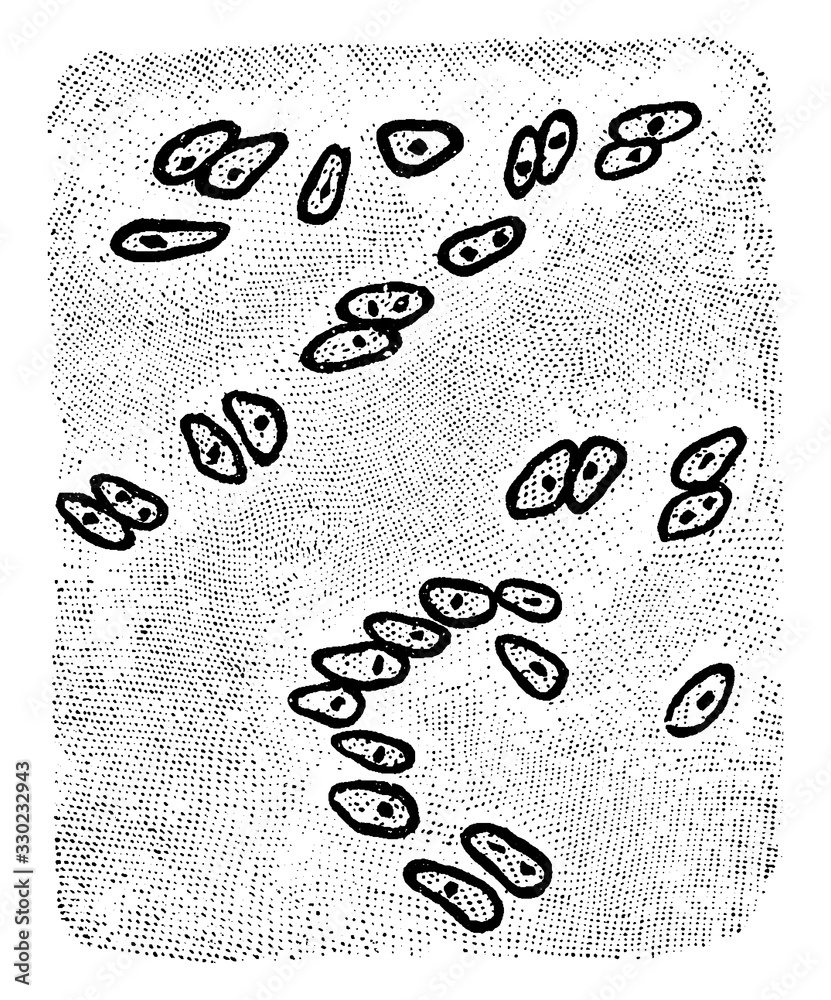 Fibrous Cartilage Diagram