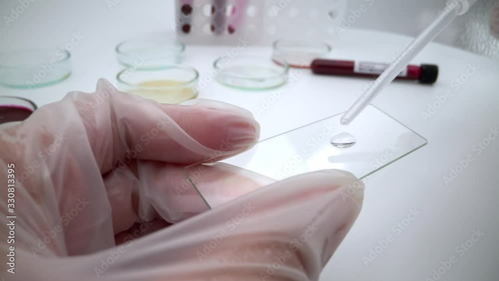 4K, Work lab testing for infectious coronavirus. COVID-19 pandemic ...