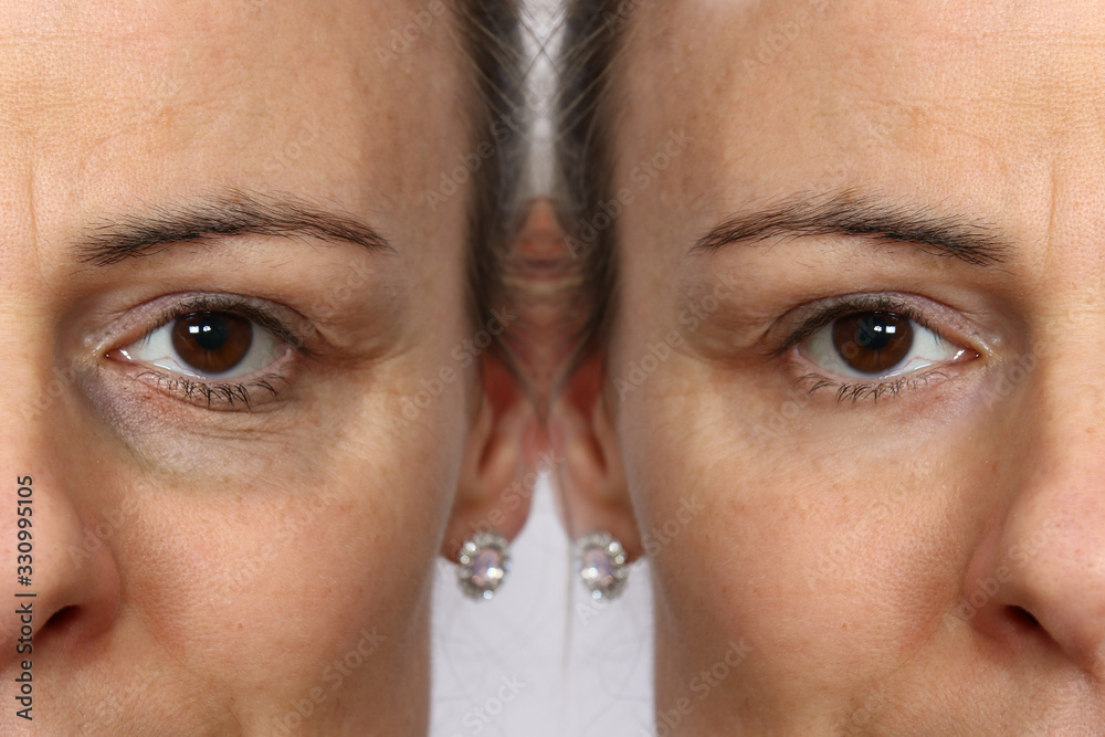 Comparison between before and after showing the results of skin ...