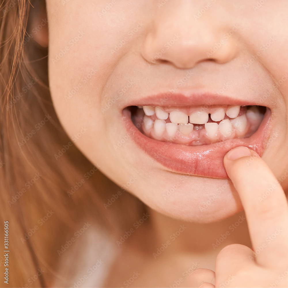 Young girl point on milk tooth. Baby losing teeth. Close up bath fenale ...