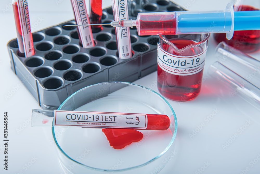 Coronavirus covid19 infected blood sample in sample tube on table in ...