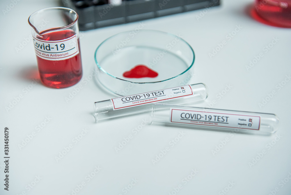 Coronavirus covid19 infected blood sample in sample tube on table in ...