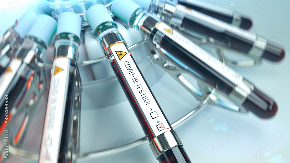 COVID-19 coronavirus test, centrifuge test tubes with blood samples ...