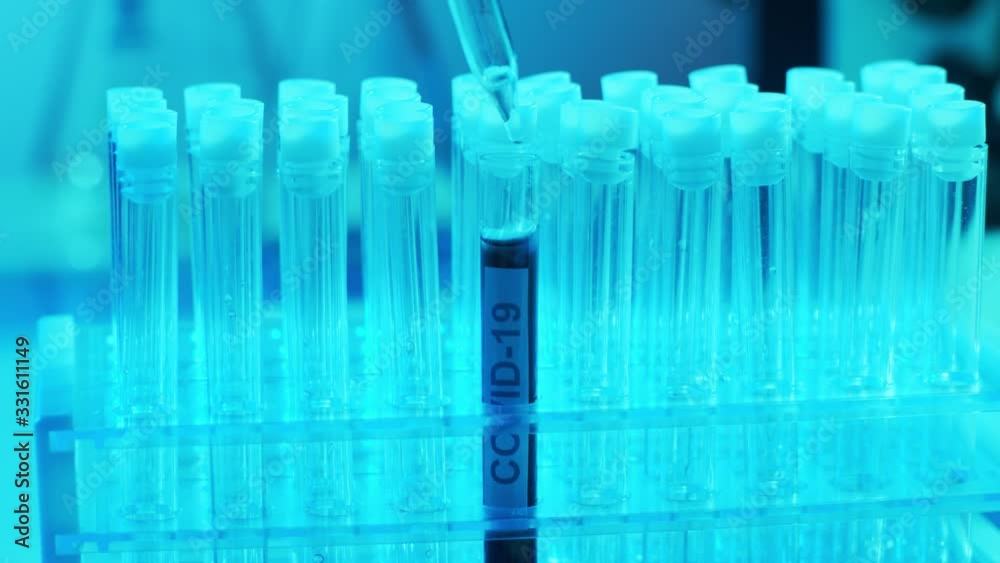 Laboratory tube with blood and virus. Scientific lab close-up. Pandemic ...