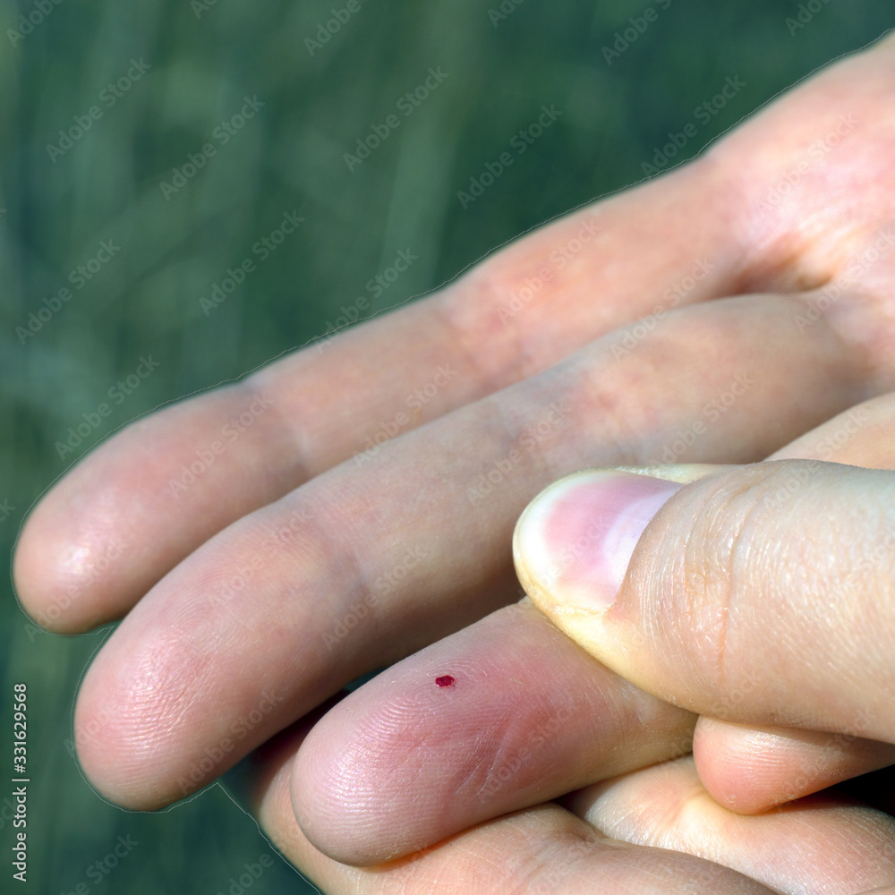 Damage to the skin on the finger from a puncture, a red drop of blood ...