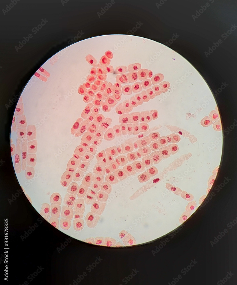 The mitosis cell of root tip onion under the light microscope. The ...