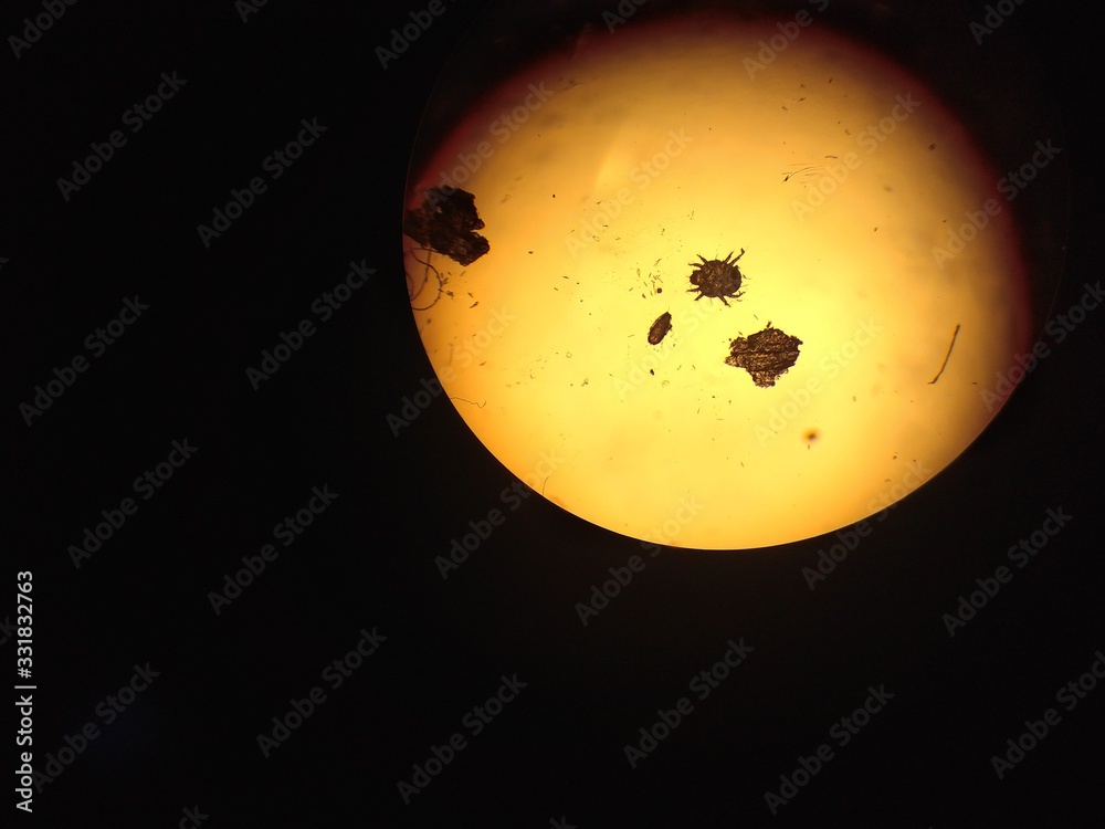 ear mite under the microscope Stock Photo | Adobe Stock