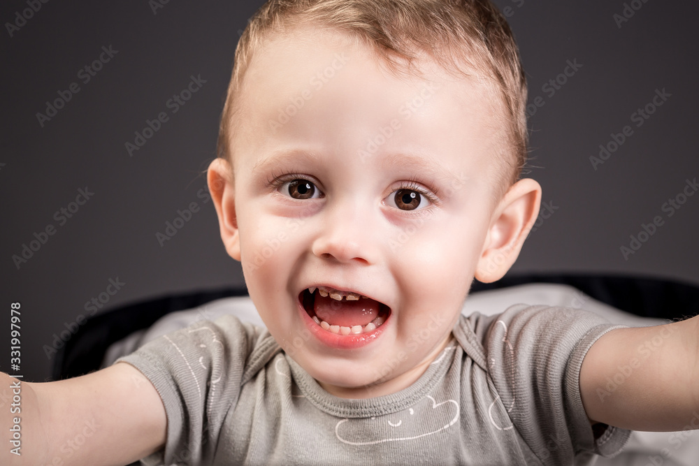 emotional smiling boy with black rotten teeth. Dental medicine and ...