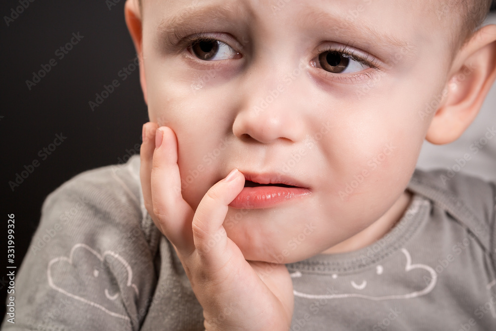 emotional sad boy with black rotten teeth afraid of dentist. Toothache ...