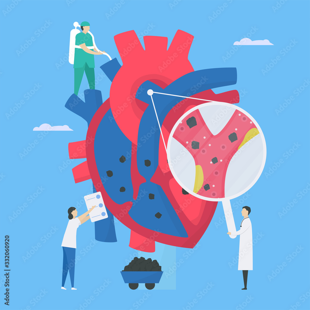 Cardiology vector illustration. This disease calls endocarditis. It is ...