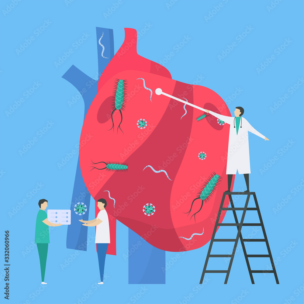 Cardiology vector illustration. This disease calls endocarditis. It is ...