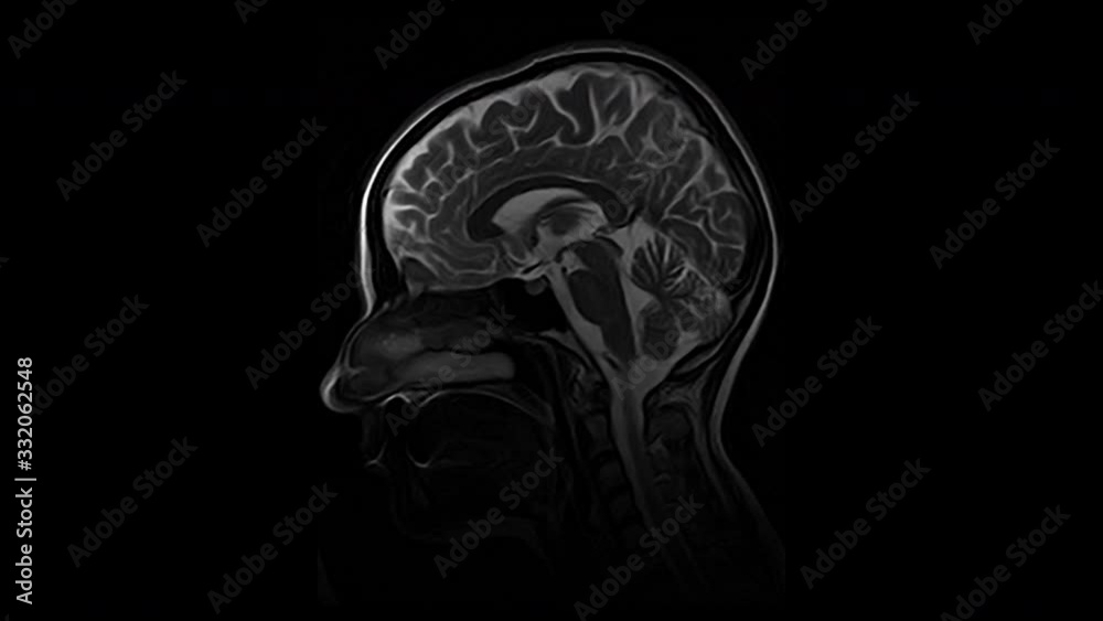 Computed medical tomography MRI upscaled scan of healthy young female ...