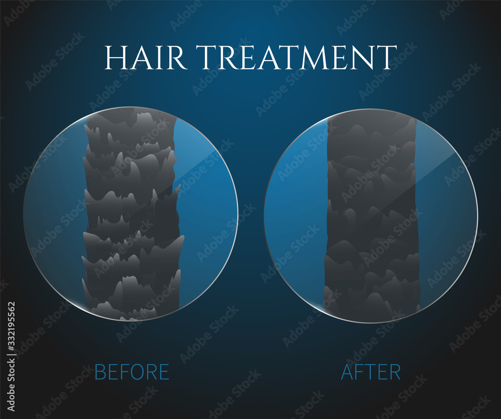 Damaged and healthy hair under the microscope. Hair follicle surface ...