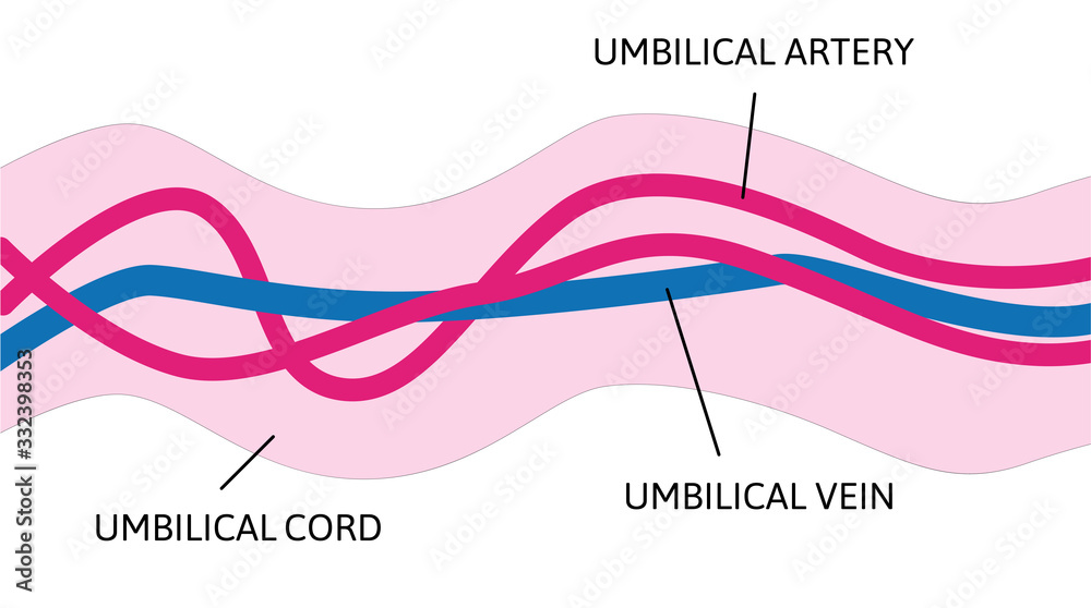 Anatomy Of Umbilical Cord Two Umbilical Veins And One Umbilical Artery