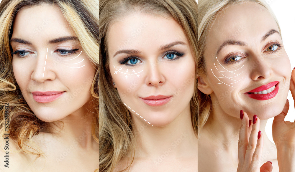 Graphic lines shows facial lifting effect on skin of beautiful woman ...