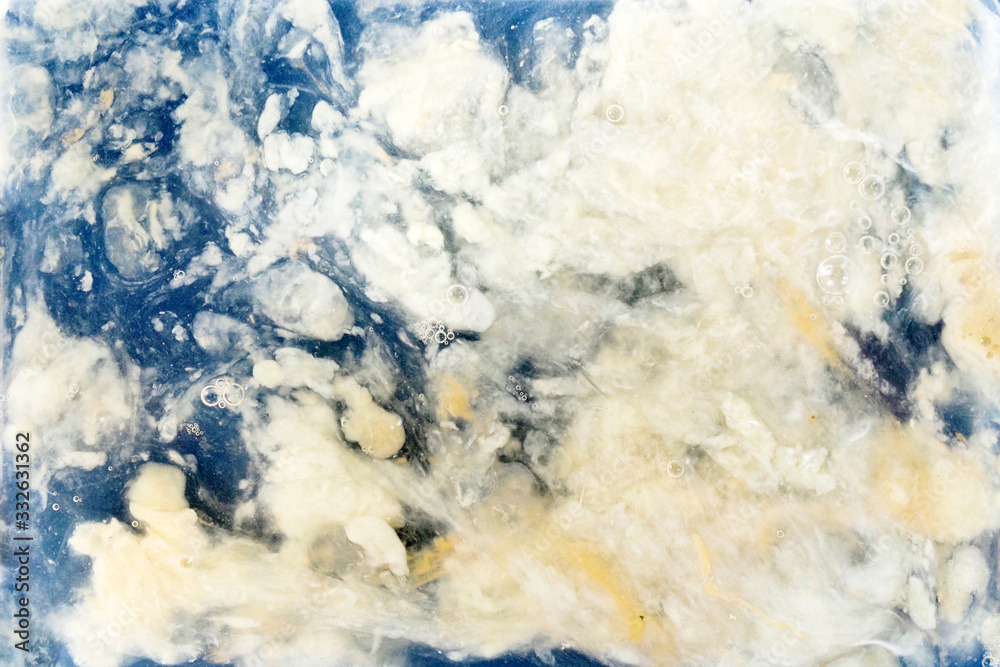 Discharge from the lungs with a viral disease background, coughing ...