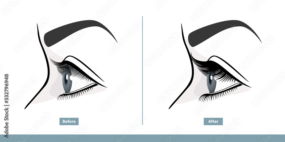 Female Eye Before and After Eyelash Extension. Comparison of Natural ...