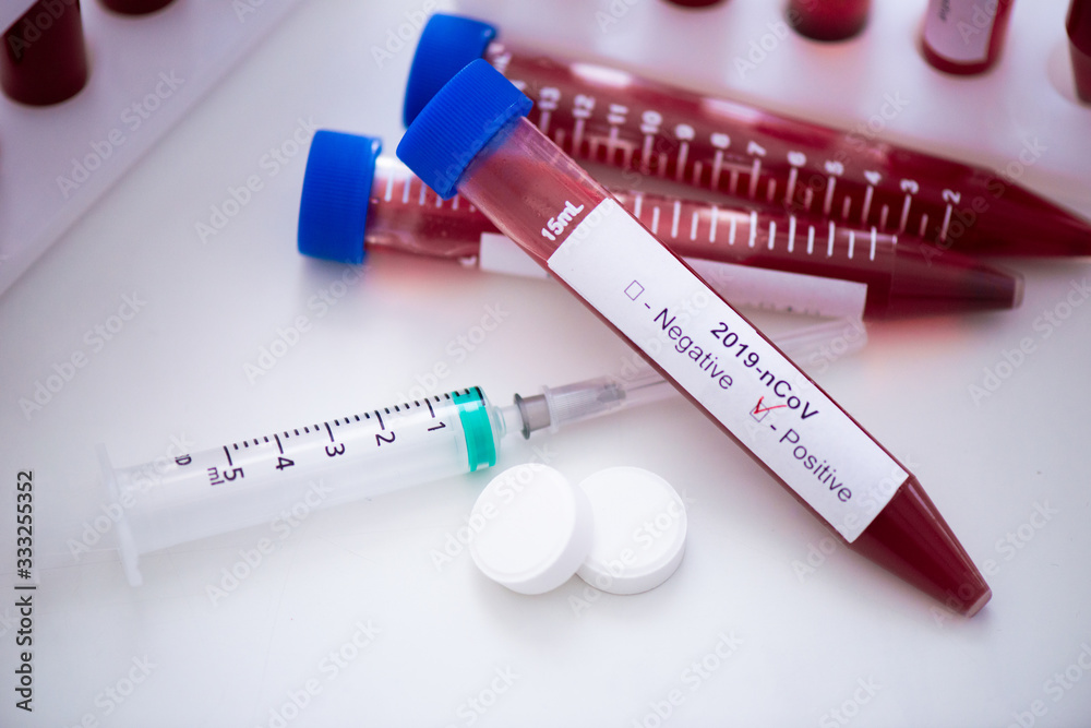 Test tube with blood sample for COVID-19 test, novel coronavirus 2019 ...