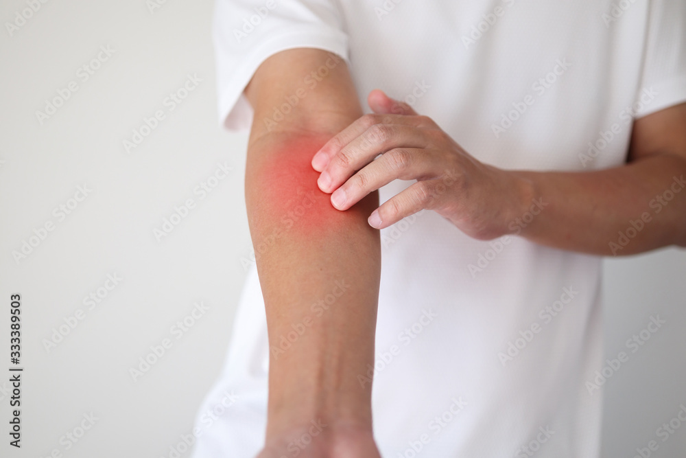 man itching and scratching on arm from itchy dry skin eczema dermatitis ...