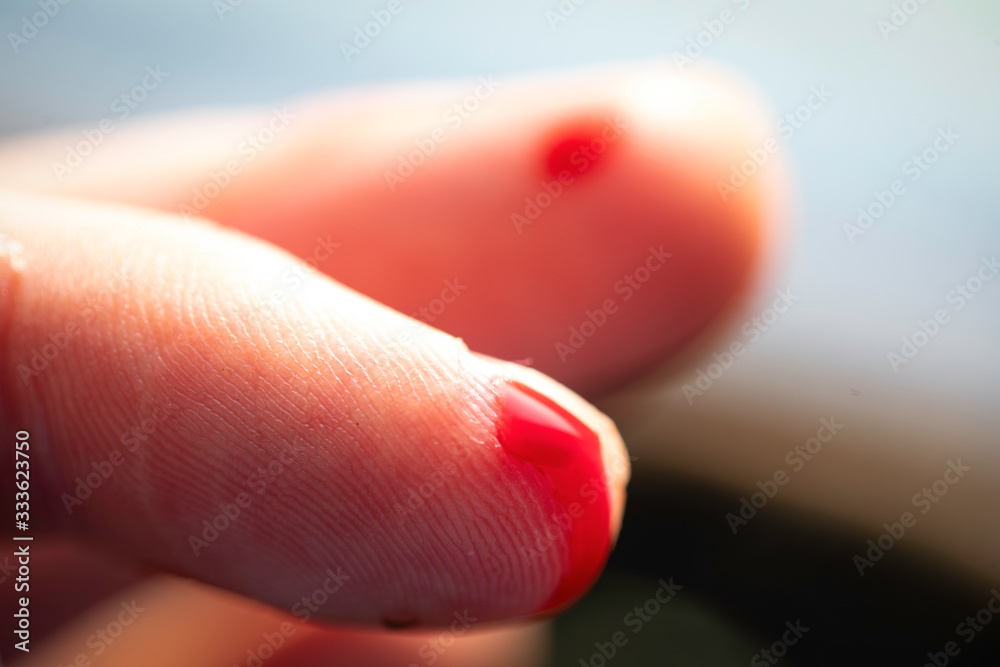 Finger cut, bleeding injured with knife, Flesh blood wound in hand ...