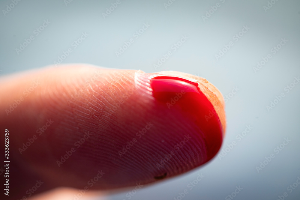Finger cut, bleeding injured with knife, Flesh blood wound in hand ...