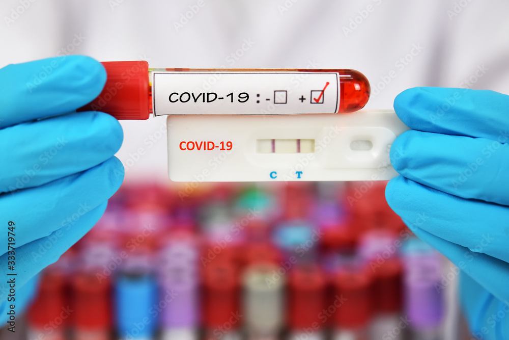 Positive test result by using rapid test device for COVID-19 virus ...