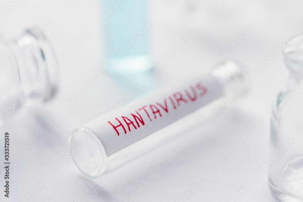 Hantavirus Sample Test Tube Background with copy space. Blank test tube ...