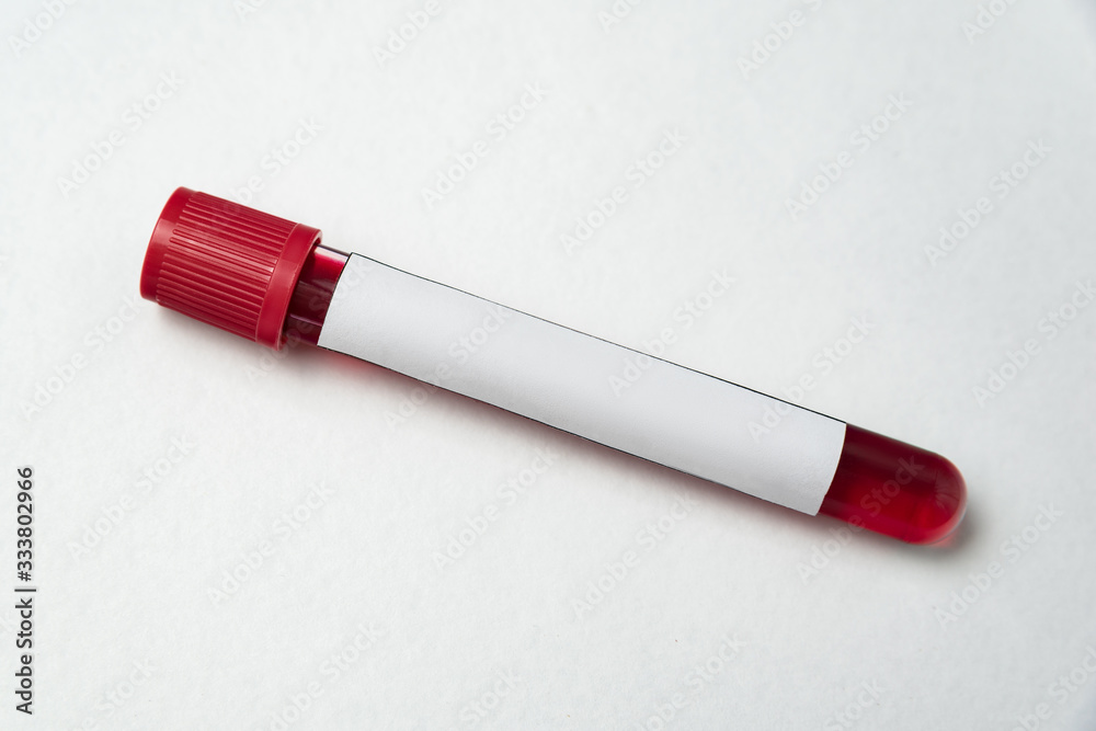 Tube with blood sample and blank label for your text. test tube on ...