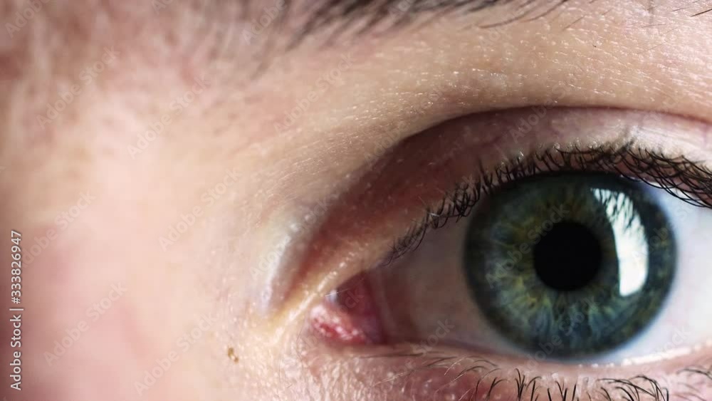 Close up macro shots of blue - green - yellowish eye reacting to light ...