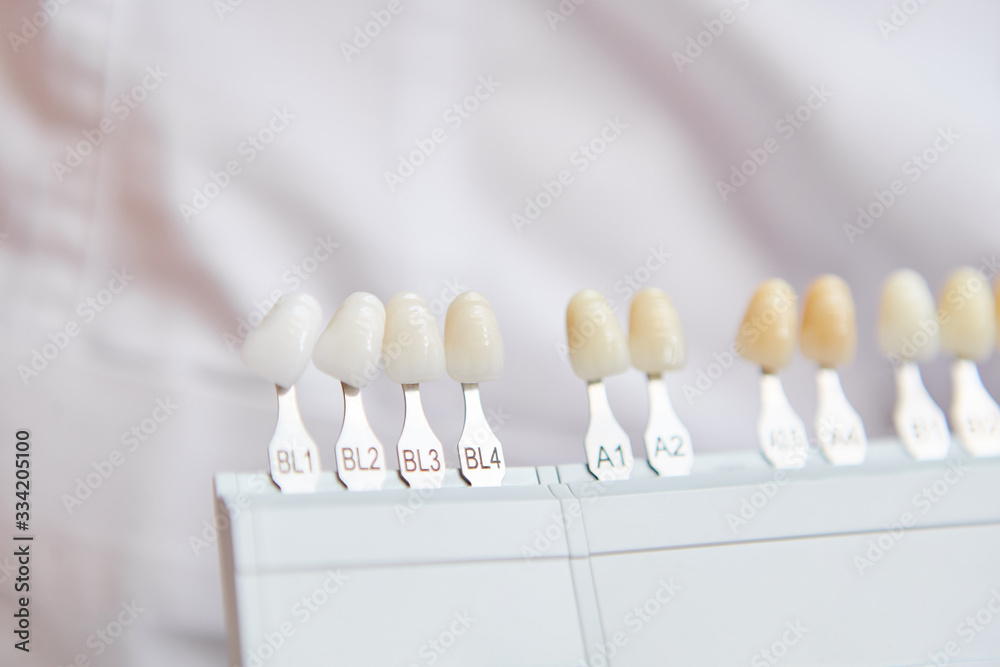 Different color levels of tooth color to choose from Stock Photo ...