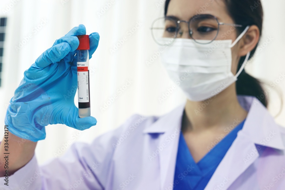 Scientist holding Coronavirus covid-19 infected blood sample tube DNA ...