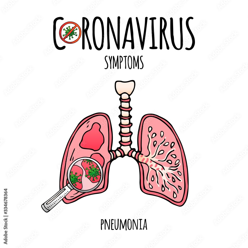 Hand drawn doodle Lungs with Noel Coronavirus causing Pneumonia ...