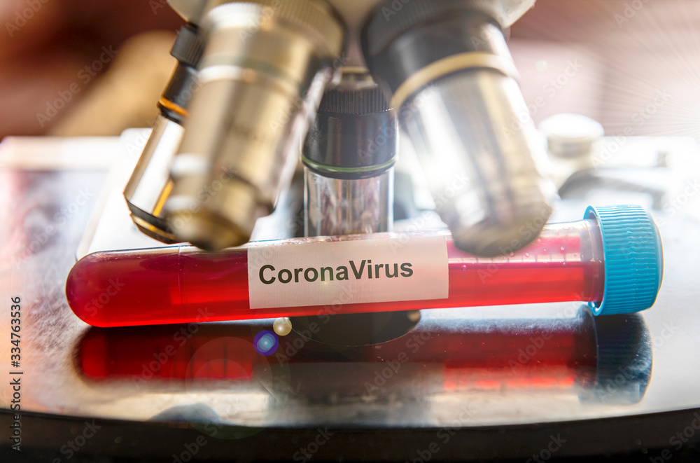 COVID-19 or CoronaVirus test tube for blood sample analyses, routine ...