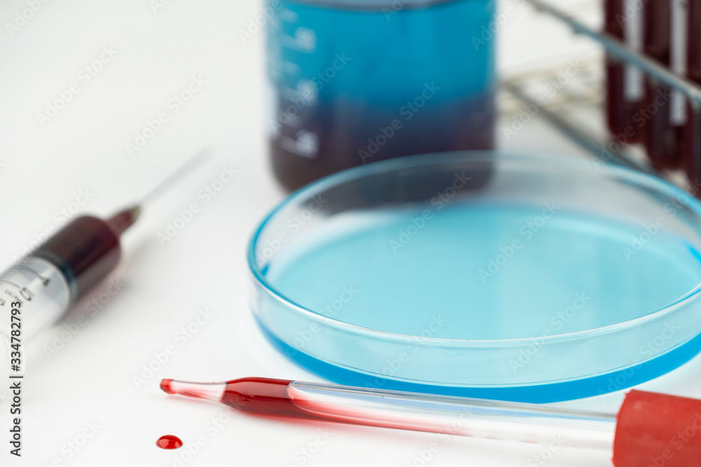 Methylene blue test liquid with blood sample for test, laboratory ...