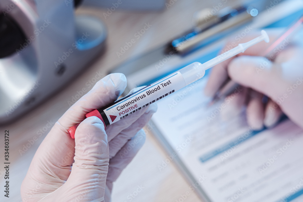 Nurse fills the form after coronavirus test. Analysis of test tube with ...