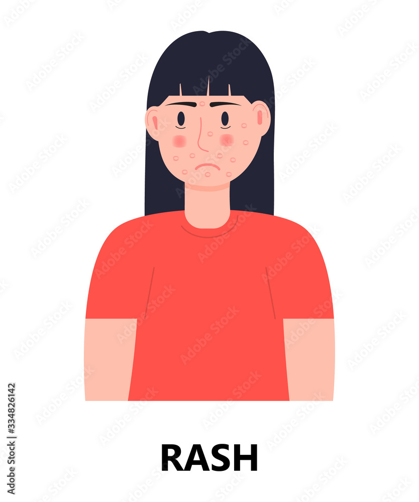 Rash icon vector. Unhappy girl with rash and acne on her face. Woman is ...