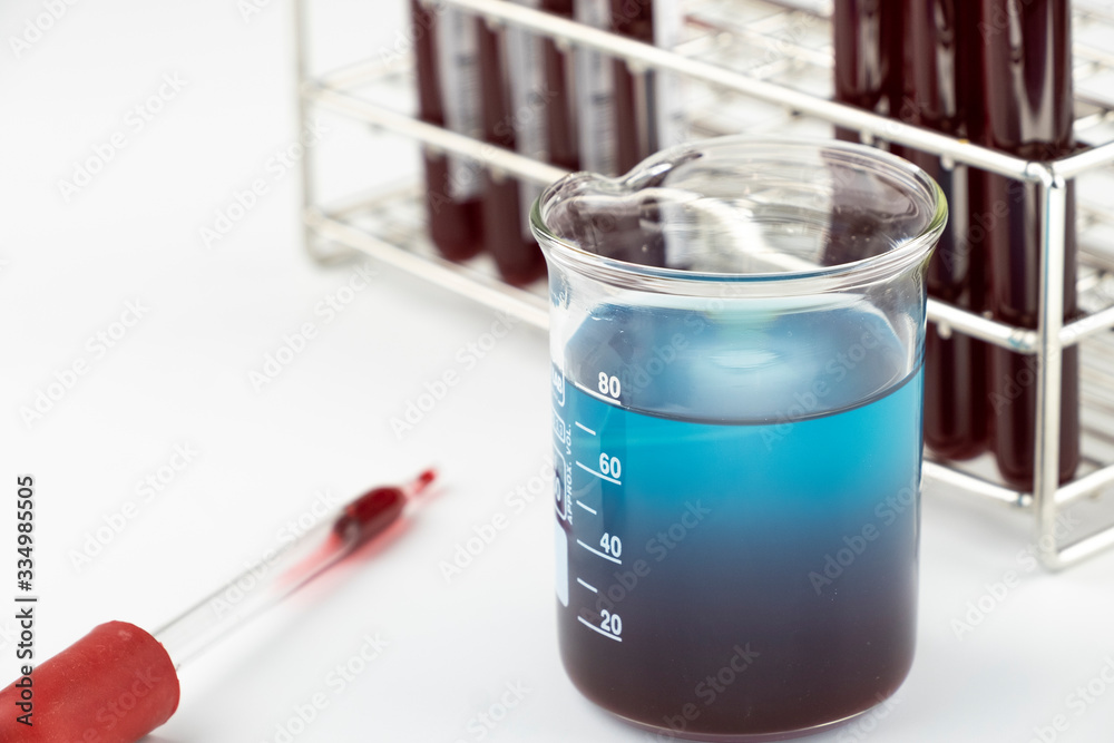 Methylene blue test liquid with blood sample for test, laboratory ...