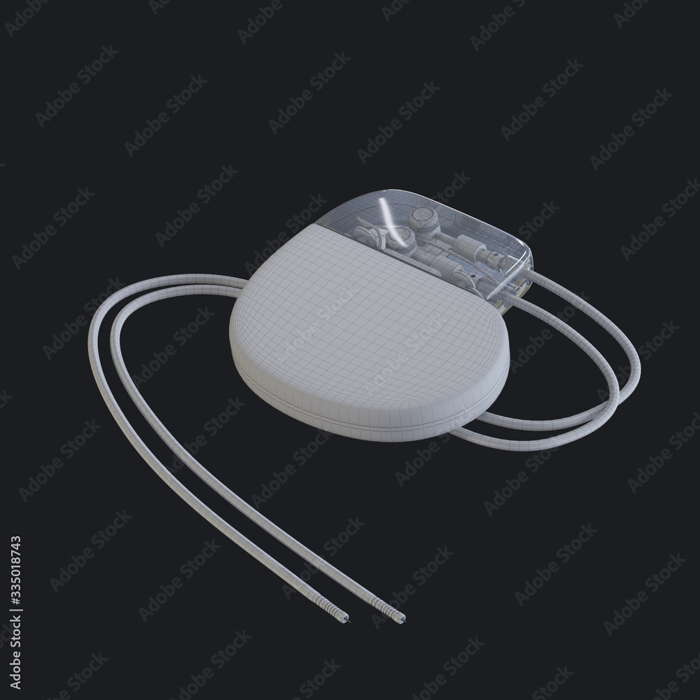 Cardiac Pacemaker Stock Photo | Adobe Stock