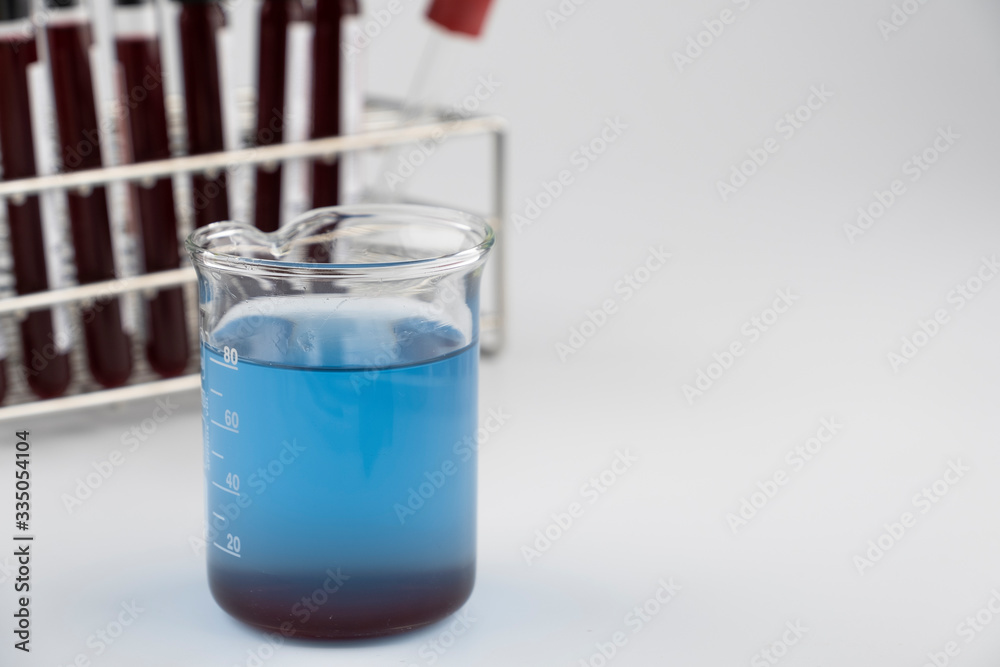 Methylene blue test liquid with blood sample for test, laboratory ...