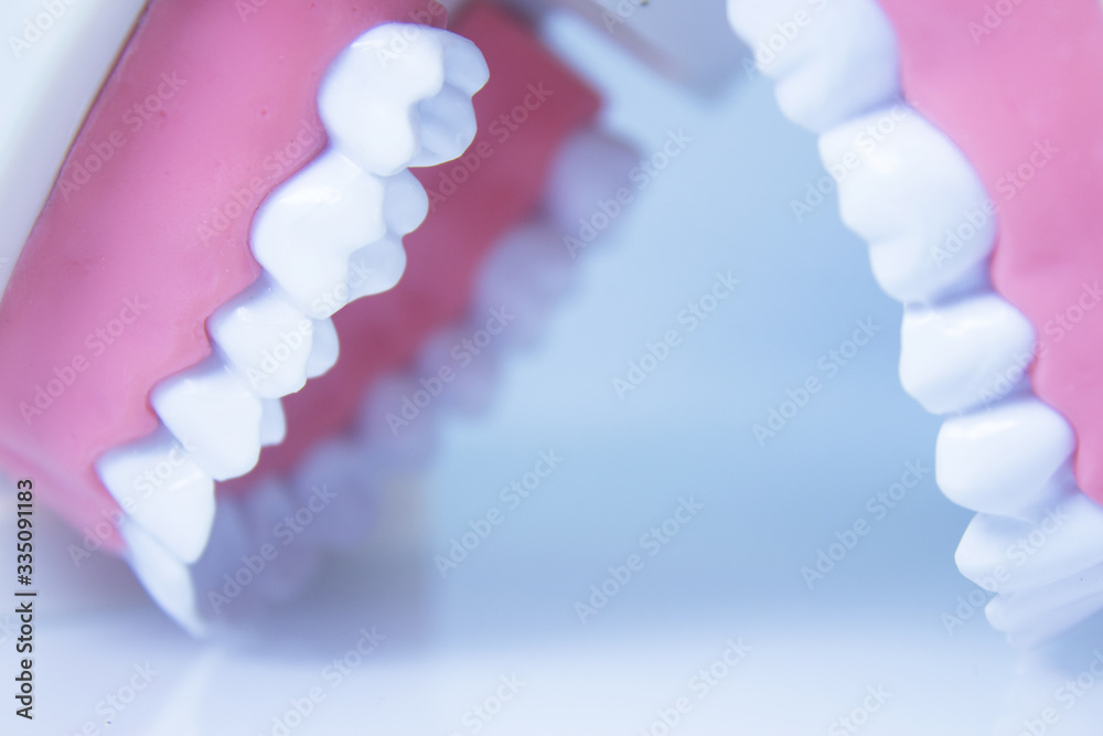 Model denture with metal orthodontics Stock Photo | Adobe Stock