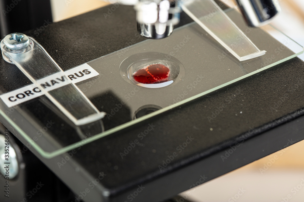 blood sample under a microscope in a laboratory, concept for testing ...