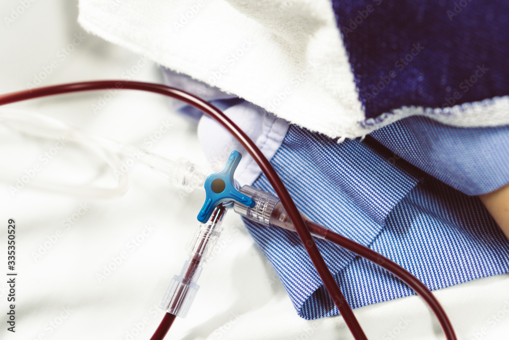 Coma patient on hopital bed take care by doctor nurse due to serious ...