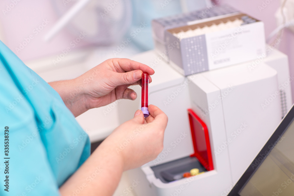 Blood analyzer. Laboratory assistant in medical laboratory holds test ...