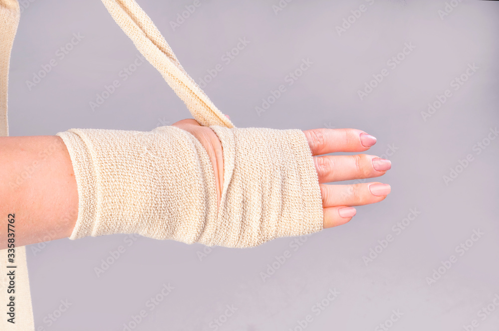 Fractures and dislocations concept. Female hand in a white bandage. A ...
