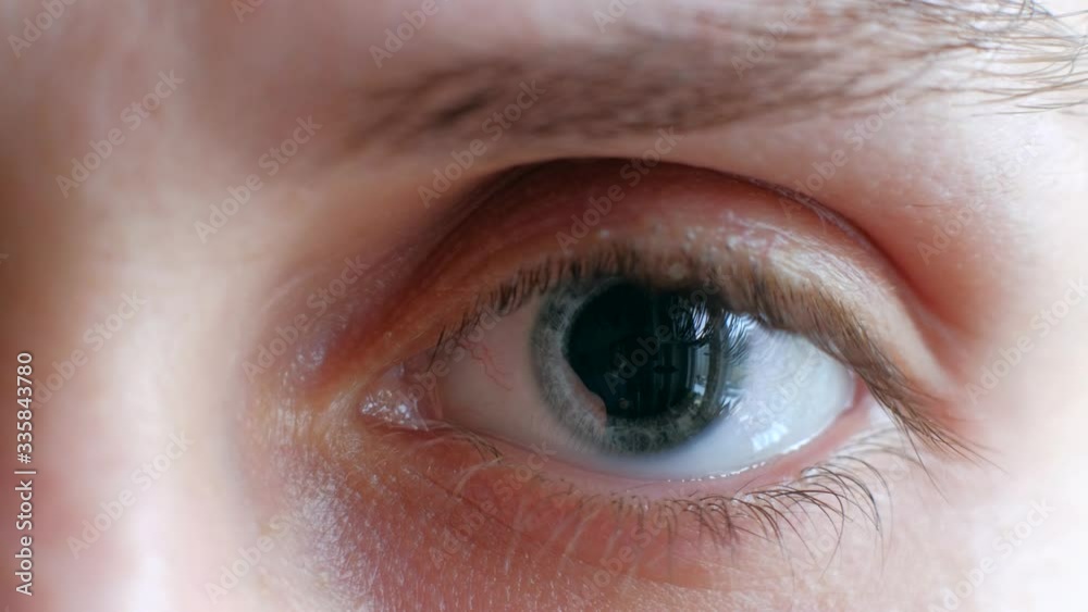 Macro footage - girl opens eye, her pupil is large due to taking drugs ...