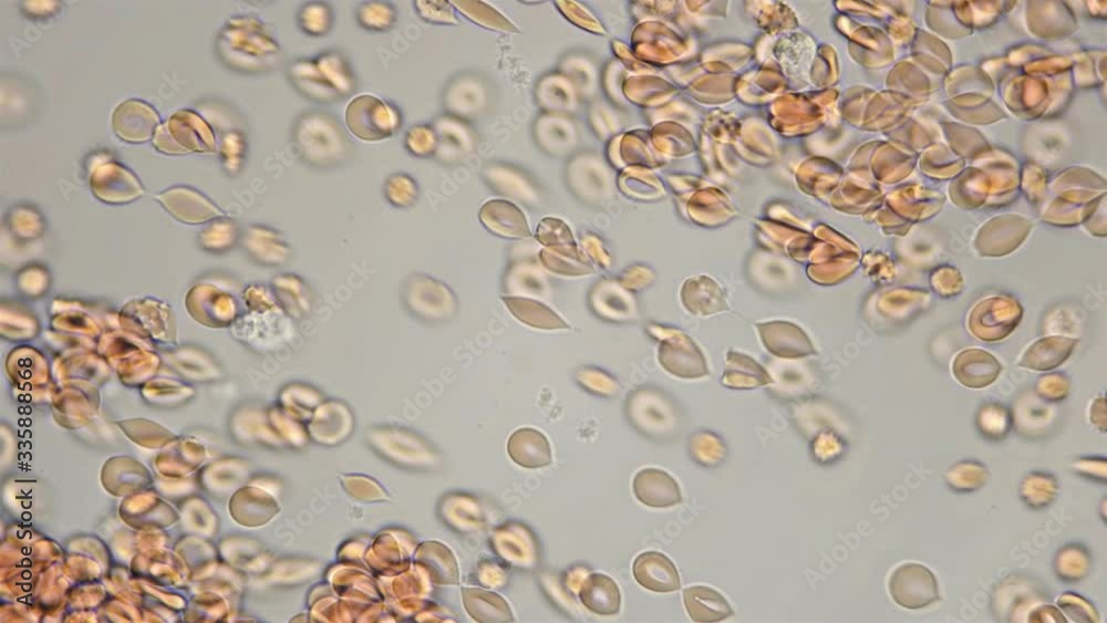 blood under a microscope, the movement of red blood cells is visible ...